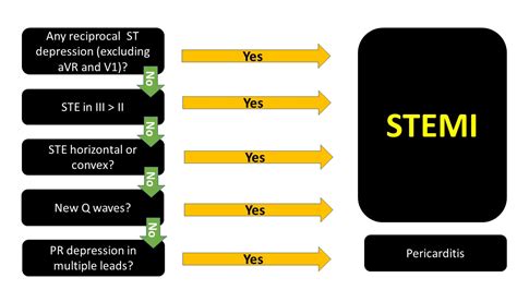 Stemi Vs Pericarditis Ecg