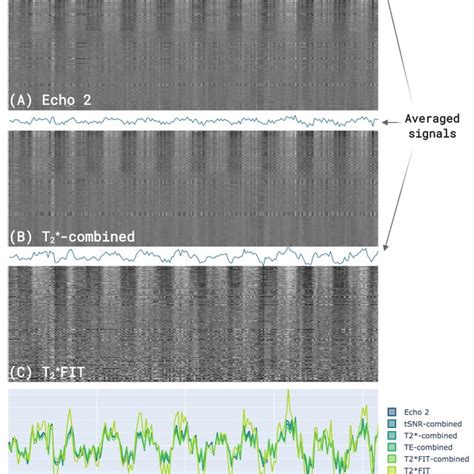 PDF The Effects Of Multi Echo FMRI Combination And Rapid T Mapping On Offline And Real