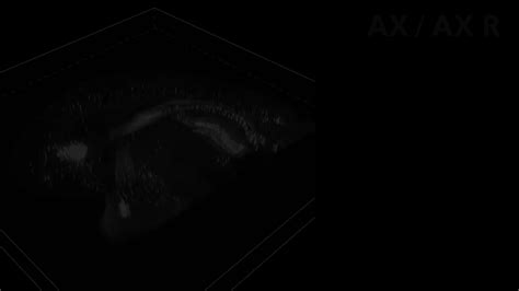 Nicholas Deakin On Linkedin Nikon Spatial Array Confocal Nsparc Detector