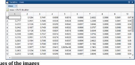 Figure 5 From Brain Tumor Discovery Using Image Preprocessing