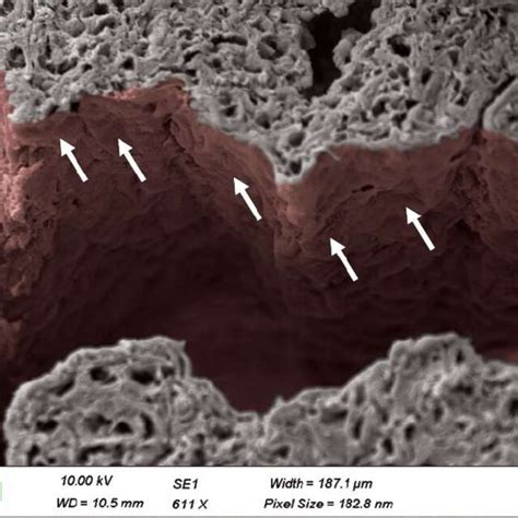Sem Electron Micrograph Of An Ampullary Portion Of The Ut Of A