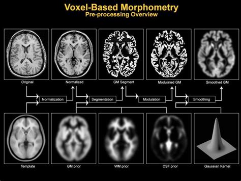 ppt vbm voxel based morphometry powerpoint presentation id 5676602