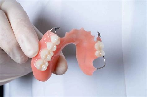 Partial Denture