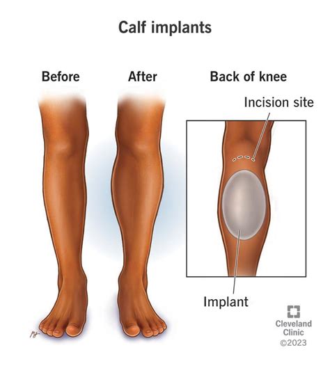 The Anatomy Of The Calf Of Leg