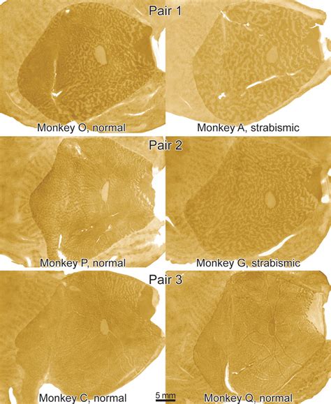 Ocular Dominance Columns In Strabismus Visual Neuroscience