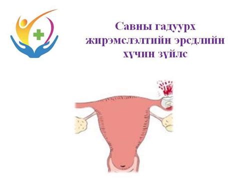 Савны гадуурх жирэмслэлтийн Гэгээн Ар Үр Эмнэлэг