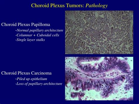 Ppt Patient Case Presentation Powerpoint Presentation Id 6925473
