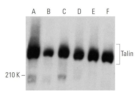 Talin Antibody Tln01 Ta205 Scbt Santa Cruz Biotechnology