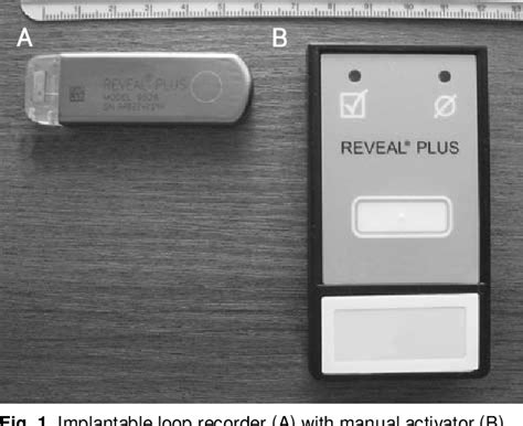 Figure From The Use Of An Implantable Loop Recorder In Patients With Syncope Of Unknown Origin