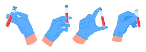 혈액 샘플을 들고 있는 실험실 작업자의 손 의사 손 와 혈액 시험관 편평한 벡터 그림 세트 실험실 조교의 손에 있는 혈액 검사관 건강 진단에 대한 스톡 벡터 아트 및 기타