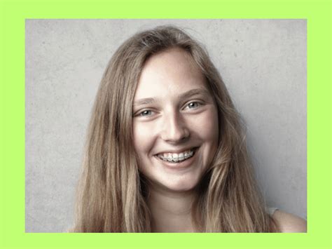 Cost Of Braces In Sydney Smiles And Faces Orthodontics