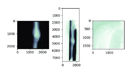 Sample Images Before Preprocessing Download Scientific Diagram