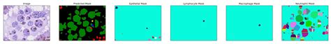 Github Aadesh 1404nuclei Segmentation Classification