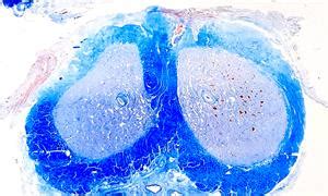 Arrayit Tissue Microarrays For Basic And Cancer Research Life Sciences Clinical And