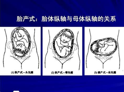 如何判断胎方位示意图有来医生