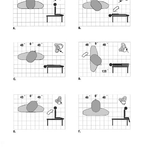 Canalith Repositioning Maneuver Positioning Sequence Is Shown For Download Scientific Diagram