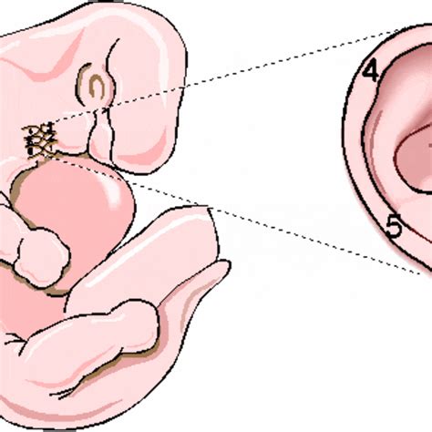 📃 Malformations Of The External Ear