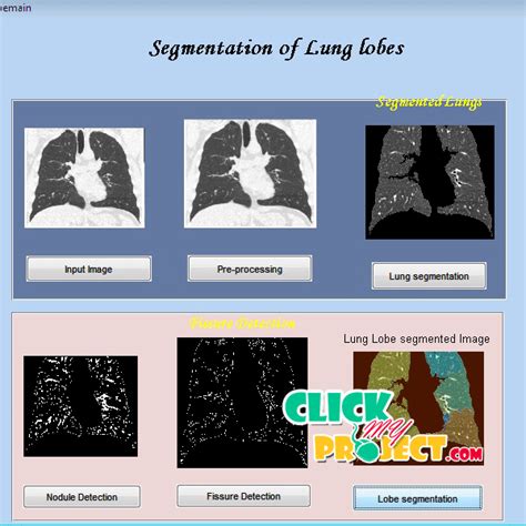 Automatic Segmentation Of The Pulmonary Lobes From Chest Ct Scans Based