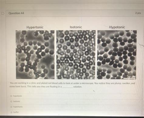 Solved Question 44 2 Pts Hypertonic Isotonic Hypotonic 20 L