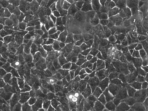 Hacat Cell Lines For Dermatological Research Cytion