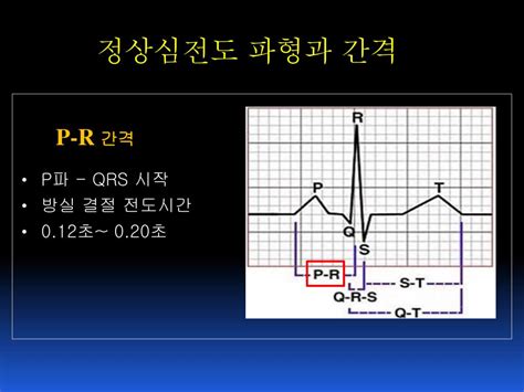 Ppt 심 전 도 Powerpoint Presentation Free Download Id 6077568