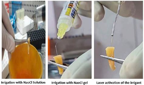 Figure 2 From Disinfection Efficacy Of Laser Activation On Different Forms And Concentrations Of