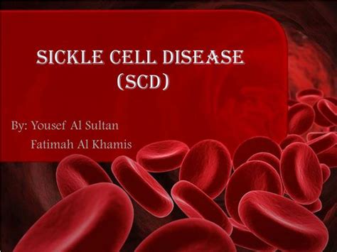 Ppt Sickle Cell Disease Scd Powerpoint Presentation Free Download Id2644910