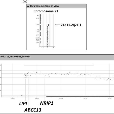 Array Comparative Genomic Hybridization Analysis On Cultured Amniocytes Download Scientific
