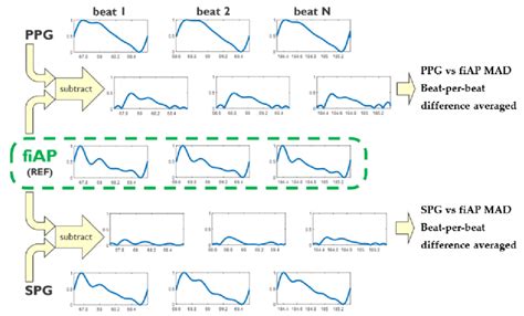 Comparison Of Ppg Top And Spg Bottom Waveform Morphologies With Download Scientific Diagram