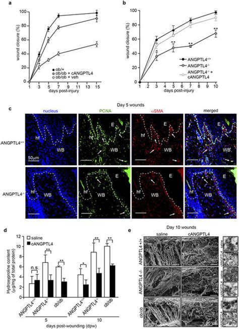 血管生成素样4诱导成纤维细胞中id3的β 连环蛋白介导的上调，以减少瘢痕胶原蛋白的表达。 Scientific Reports X Mol