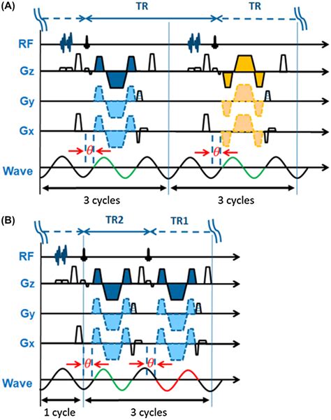 Schematic Pulse Sequence Diagram Of SC MRE And Proposed FASTWALTZ A Download Scientific