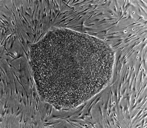 Purified Fat Stem Cells Can Grow Bone Faster Say Scientists