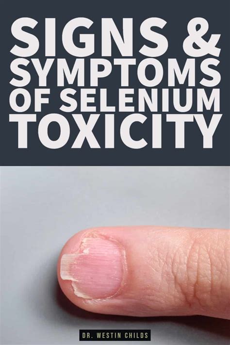 Signs And Symptoms Of Selenium Toxicity