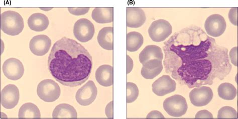 Normal Monocytes