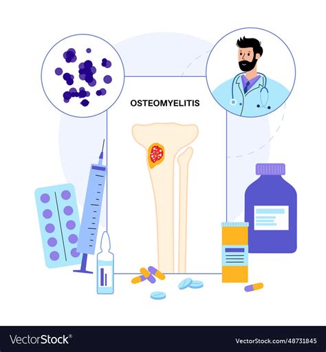Tibia Bone Osteomyelitis Royalty Free Vector Image
