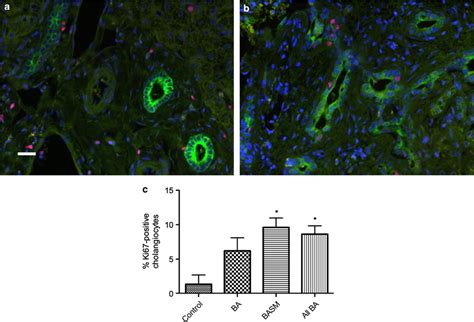 Cholangiocyte Proliferation By Ki67 Immunofluorescence Microscopy Download Scientific Diagram