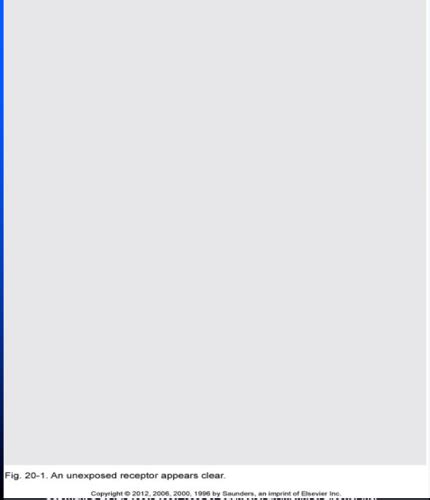 Radiology Errors Flashcards Quizlet Radiology Errors Flashcards Quizlet