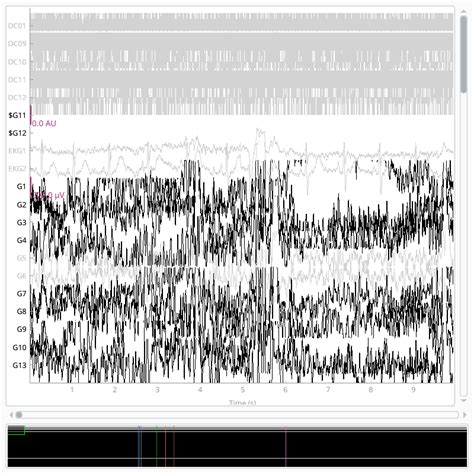 load ieeg data example — ieeg pipelines 0 7 0 documentation