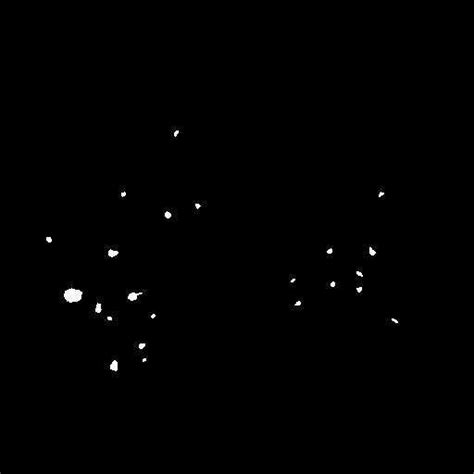 Extracted Candidate Nodules Download Scientific Diagram