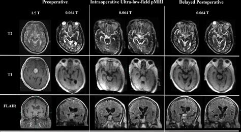 Surgical Neurology International