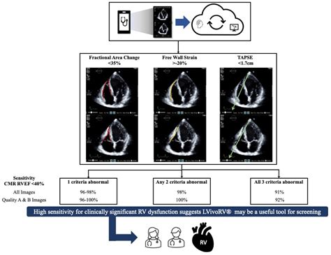 Validation Of American Society Of Echocardiography Guideline Recommended Parameters Of Right