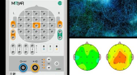 Qeeg Neuroguide Wineeg Healthcareproviders Brainmapping Clinicaldocumentation Kelly Feely