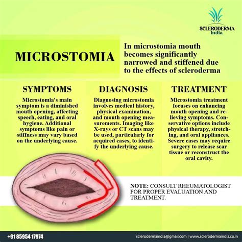 Microstomia Scleroderma Systemicsclerosis Chronicillness Rheumatology Scleroderma India