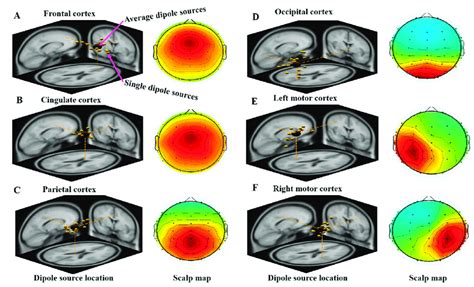 Eeg Dipole Source Location And Scalp Map Of Six Clusters Including A