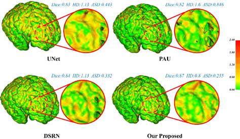 Figure 1 From A Deep Attentive Convolutional Neural Network For Automatic Cortical Plate