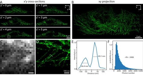 Super Resolution Stochastic Optical Reconstruction Microscopy Storm