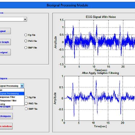 The Application Of Wavelet Analysis On ECG Signal Download Scientific Diagram