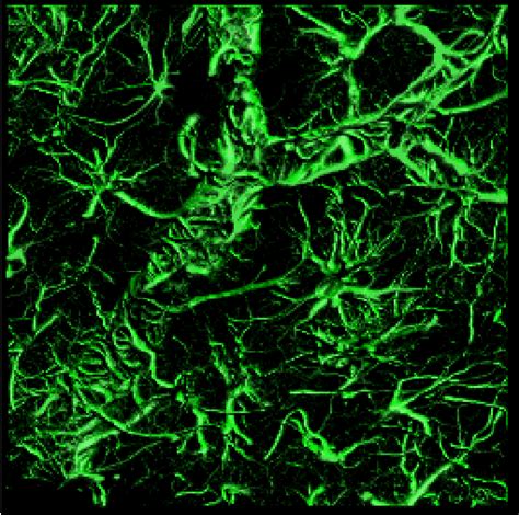 Example Of An Input Data Set Composed Of 42 Slices Of 256 × 256 Density