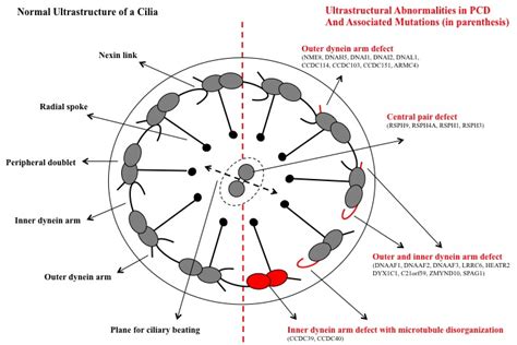 Ciliary Dysfunction Treatment And Management Point Of Care