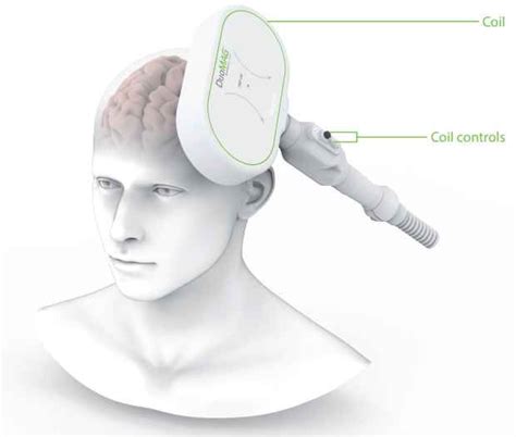 La Stimulation Magnétique Transcrânienne Répétitive Rtms